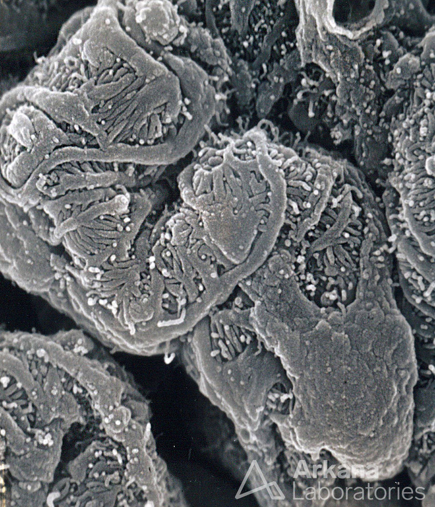 Interdigitating Podocyte Foot Processes | eyeSCANdy