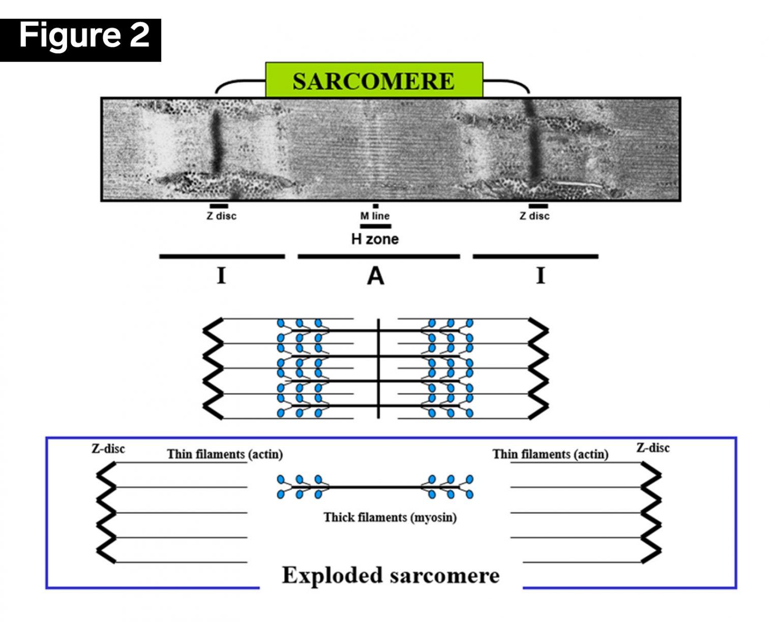 Sarcomere Bundles of the A Zone | Neuro Notes | Arkana Laboratories