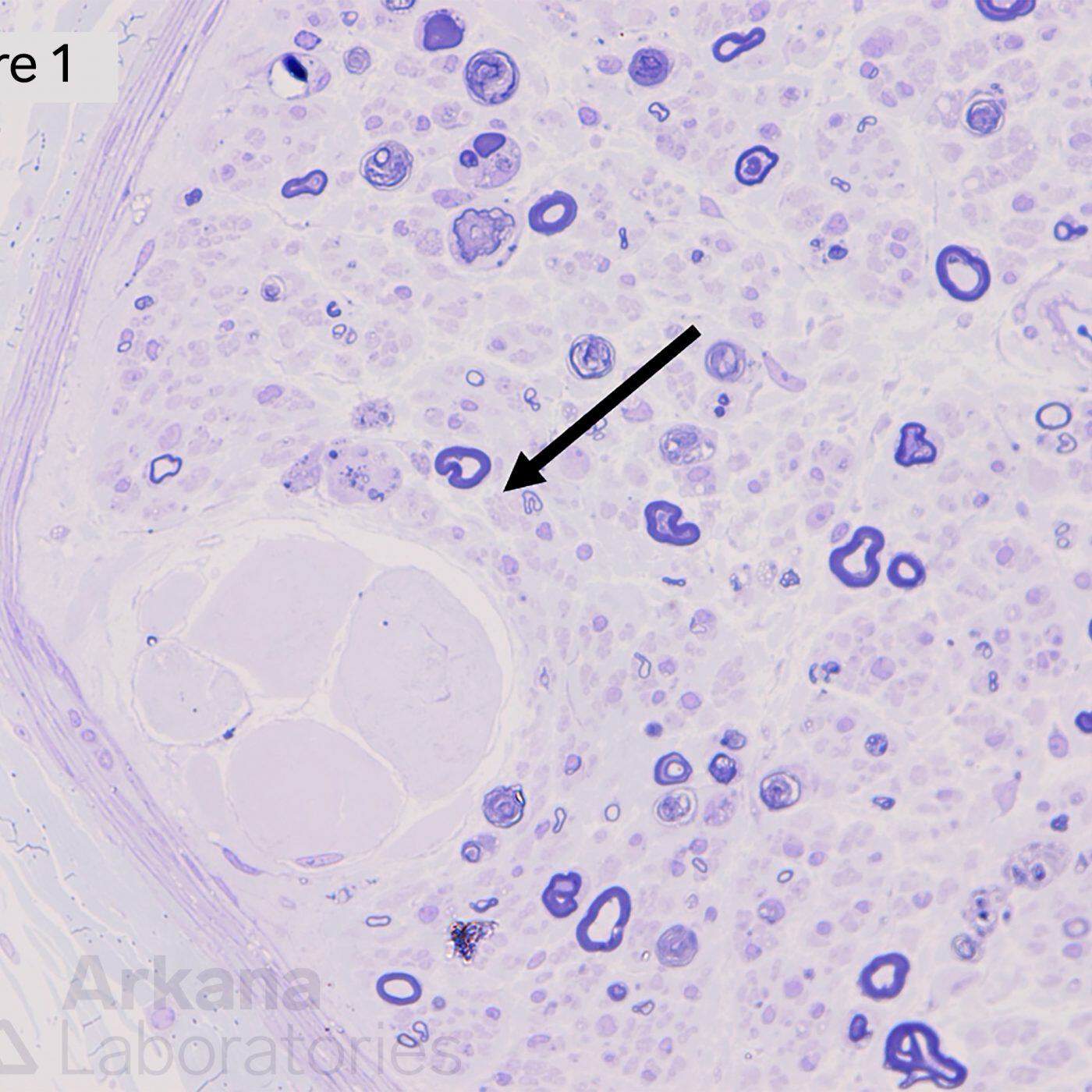 Muscle Fiber Spindle | Neuro Notes | Arkana Laboratories
