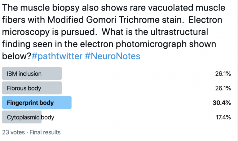 Fibrous Body (Filamentous Body) | Neuro Notes | Arkana Laboratories