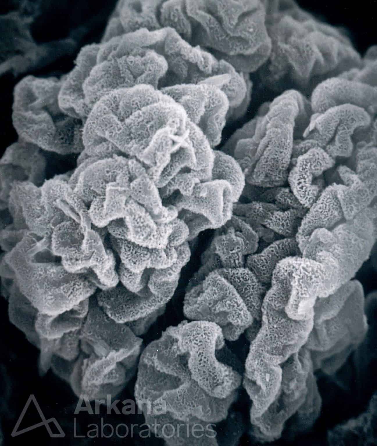 Diffuse Reticular Appearance of GBM | eyeSCANdy | Arkana Labs