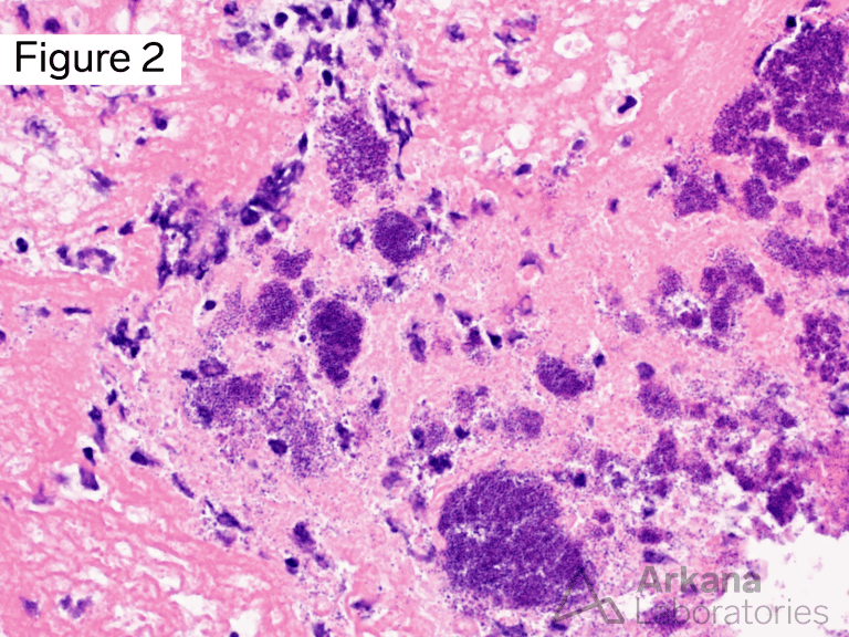 Tissue Gram Stain | Neuro Notes | Arkana Laboratories