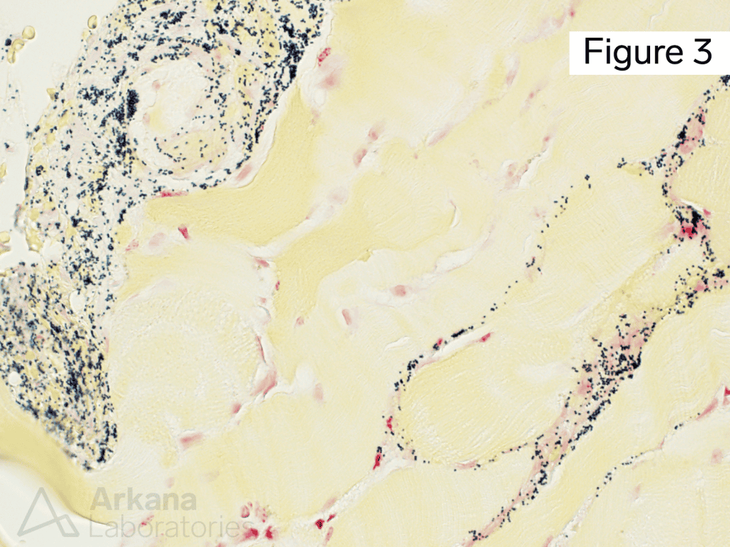 Tissue Gram Stain | Neuro Notes | Arkana Laboratories