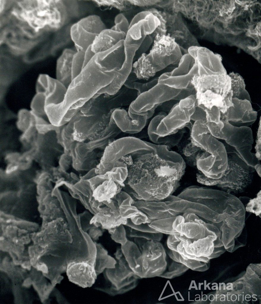 Glomerular Tuft | eyeSCANdy | Arkana Laboratories