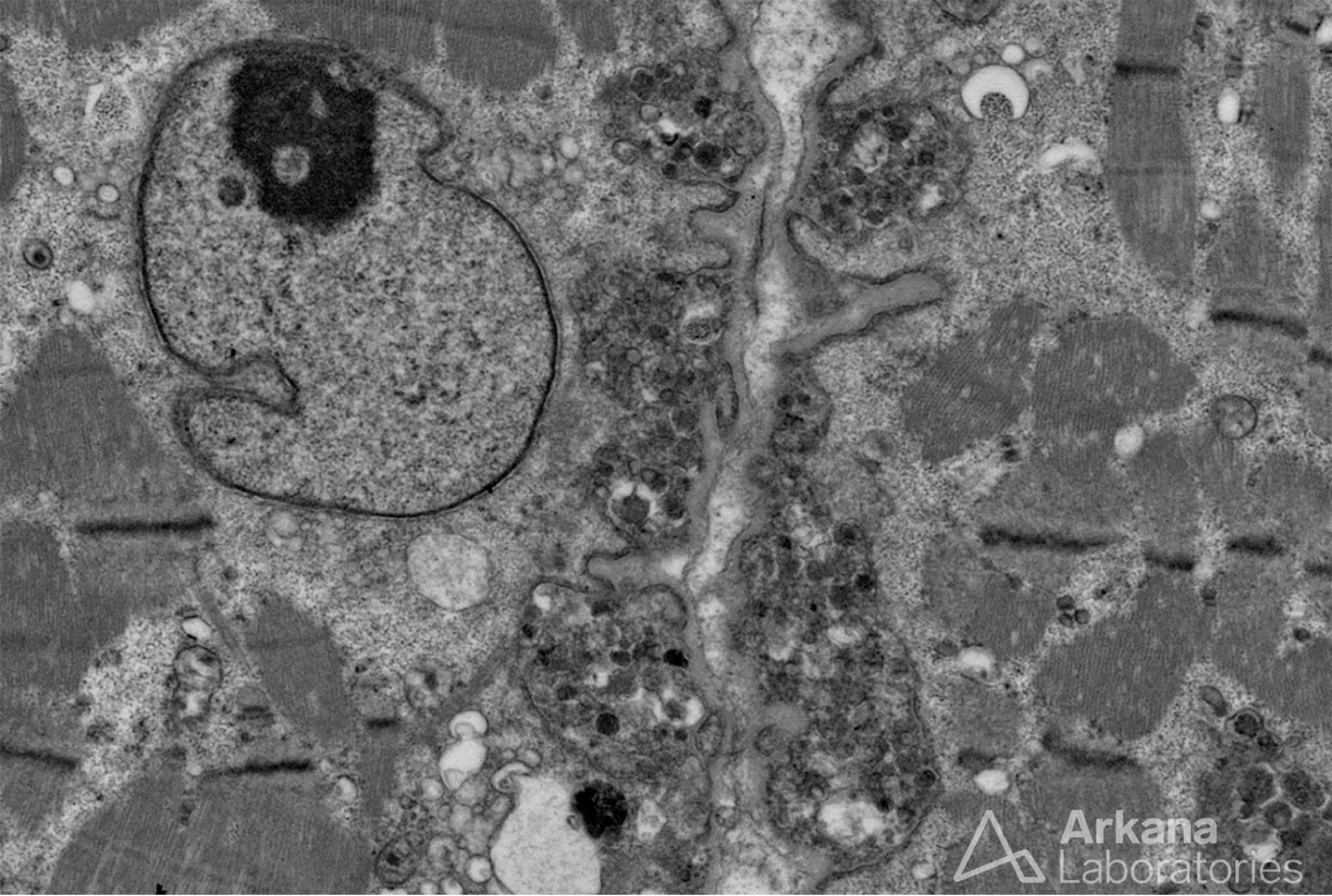 Exocytosis in a Muscle Biopsy | Neuro Notes | Arkana Laboratories