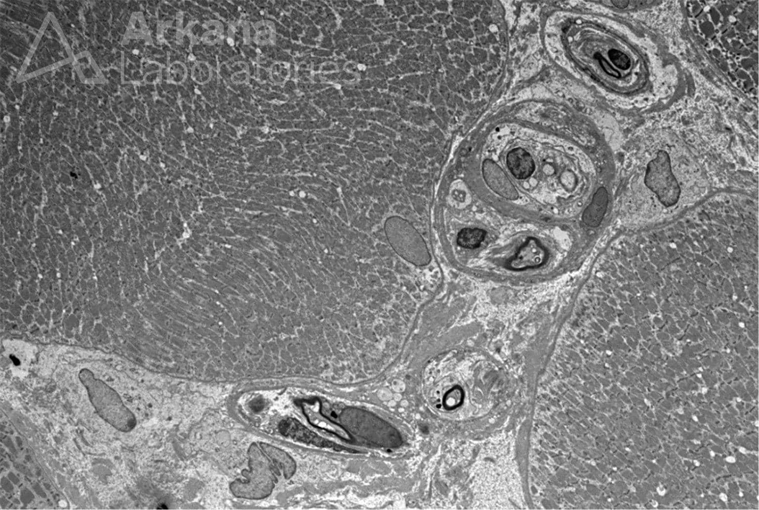 Nerve Twigs Within Endomysial Connective Tissue | Neuro Notes