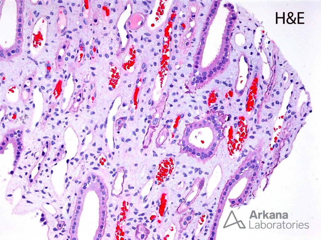 Randall's Plaques | Teaching Points | Arkana Laboratories