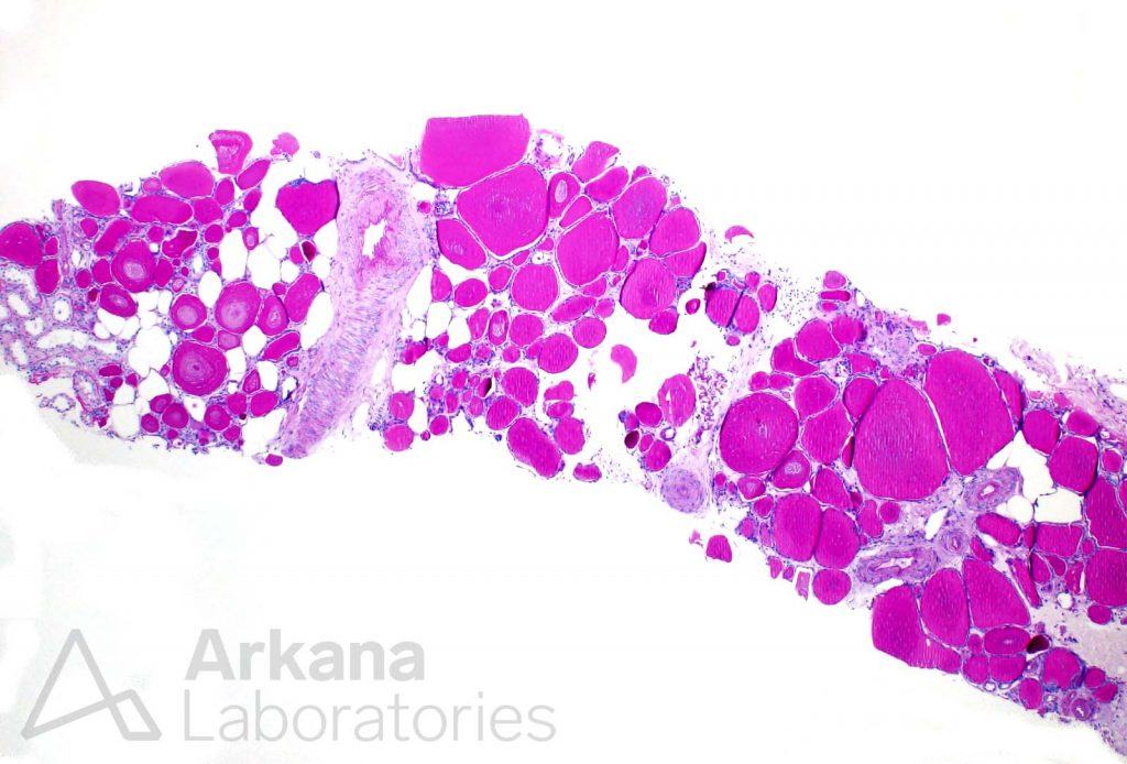 Thyroidization | Teaching Points | Arkana Laboratories