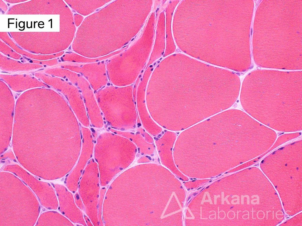 Target Fibers On Trichrome | Neuro Notes | Arkana Laboratories
