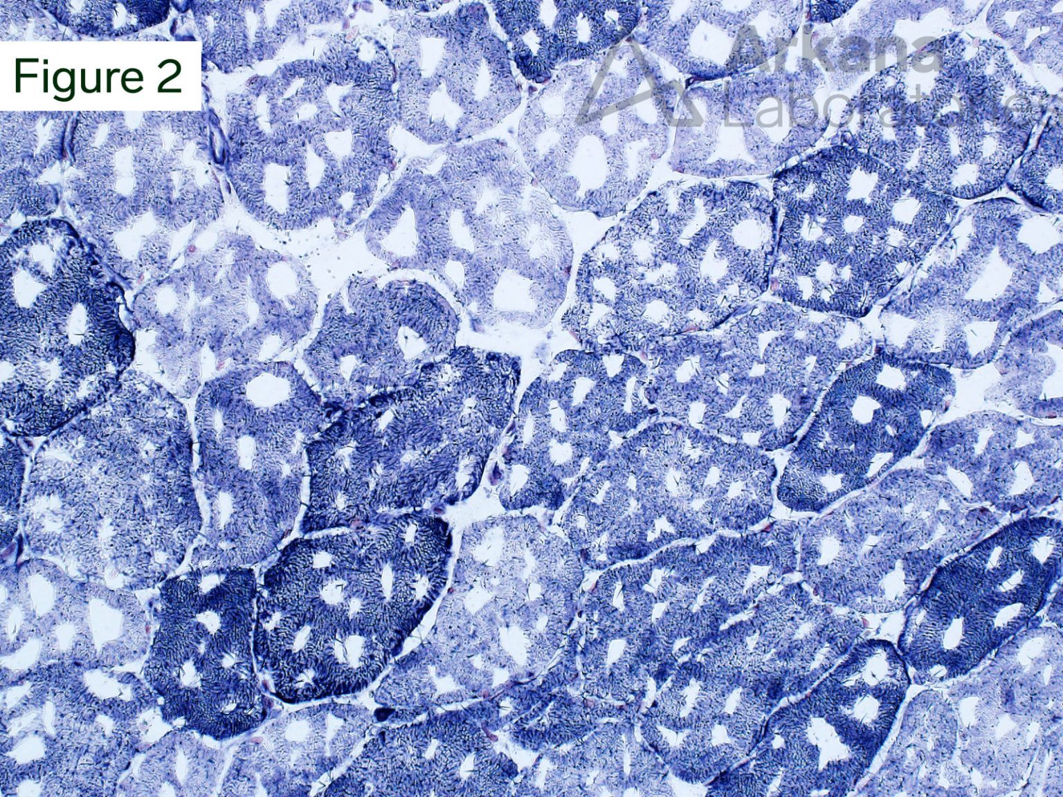 Freezing Artifact | Neuro Notes | Arkana Laboratories