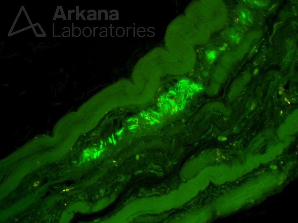 Thioflavin T sIBM | Neuro Notes | Arkana Laboratories