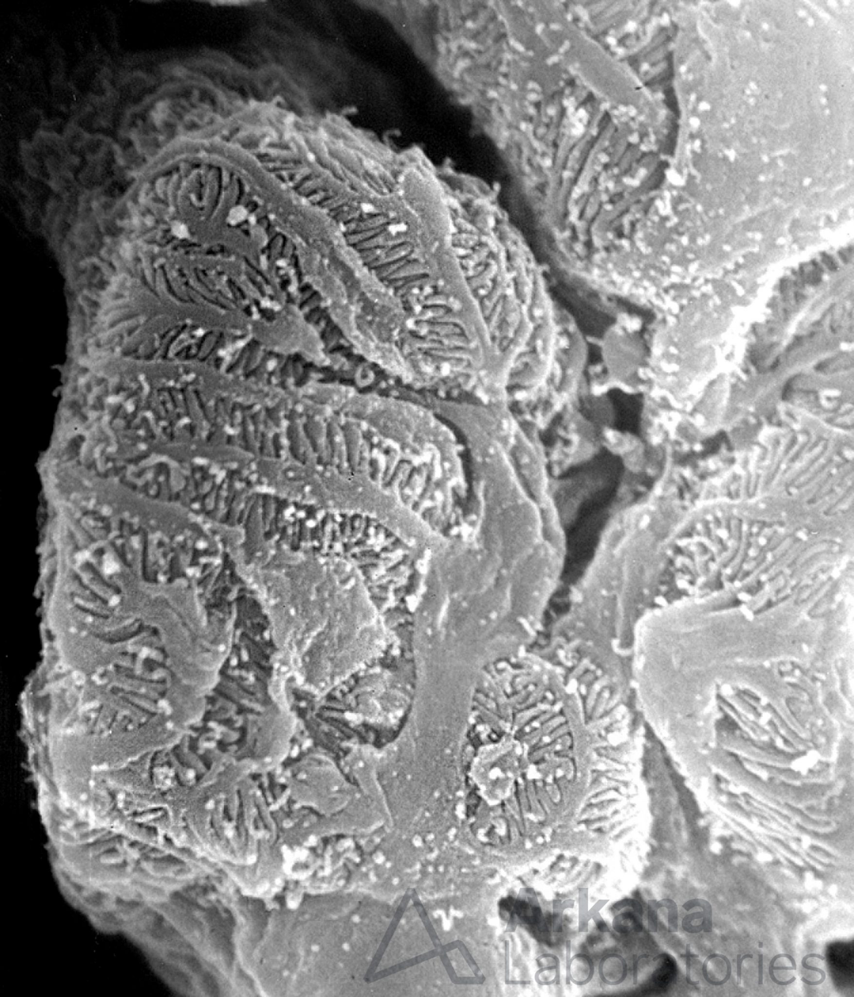 Interdigitating Podocyte Foot Processes | eyeSCANdy | Arkana Labs