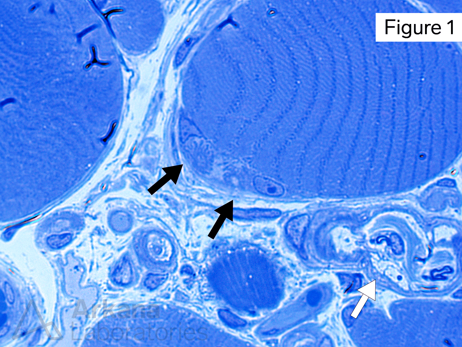 Neuromuscular Junction Thick Section | Neuro Notes