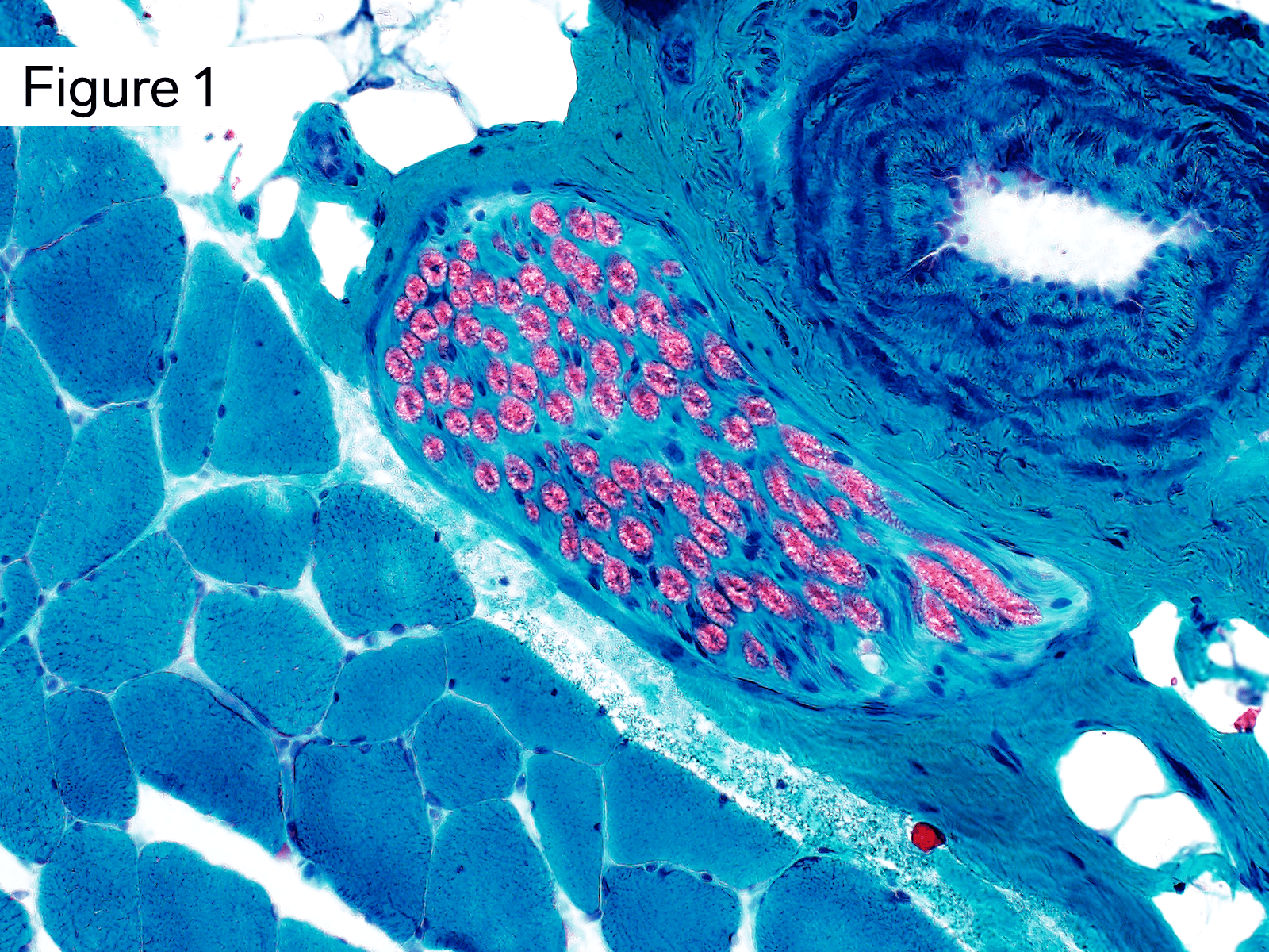 Peripheral Nerve Fascicle | Neuro Notes with Dr. Wilson