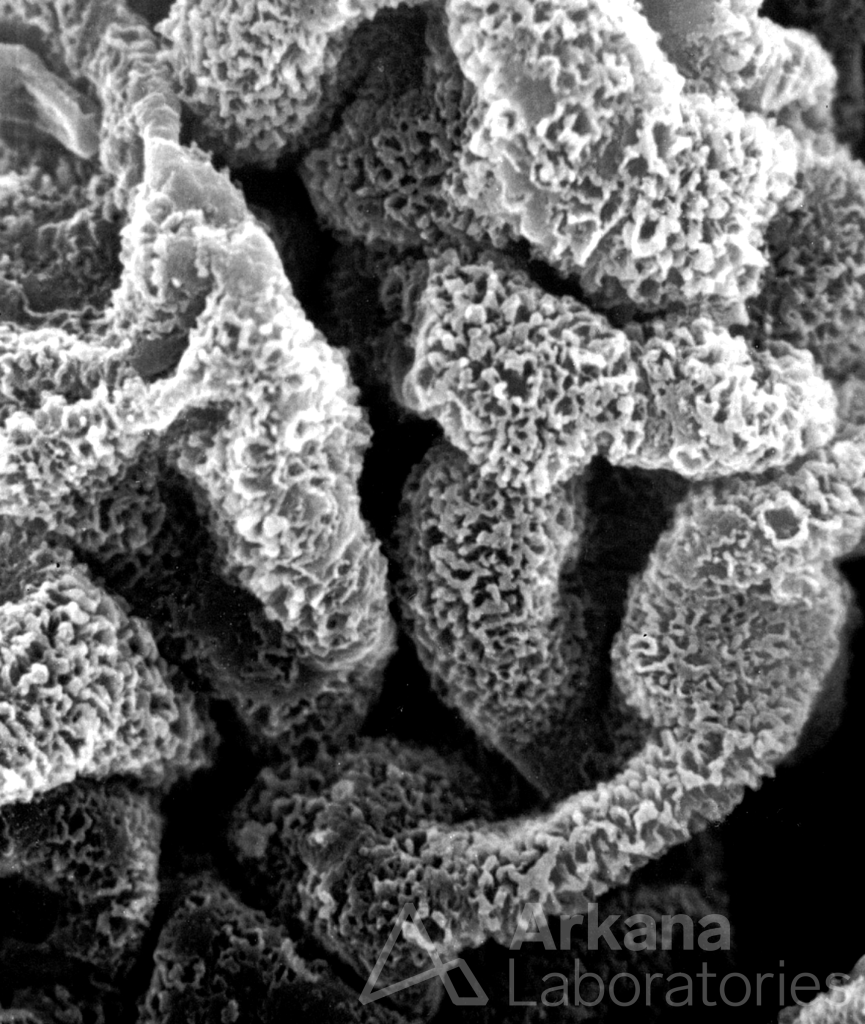 Glomerular Capillary Loops | eyeSCANdy with Dr. Bonsib