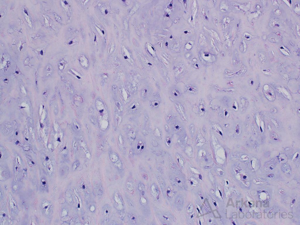 Unusual Dural Mass | Neuro Notes | Arkana Laboratories