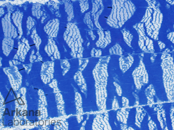 Contraction Band Artifact - Arkana Laboratories