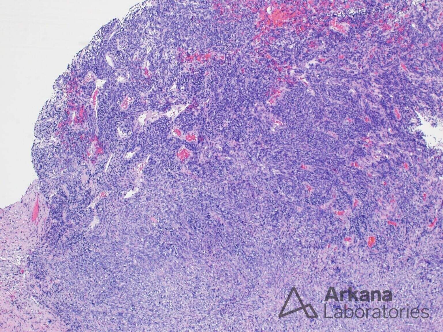 Dural Mass - Arkana Laboratories