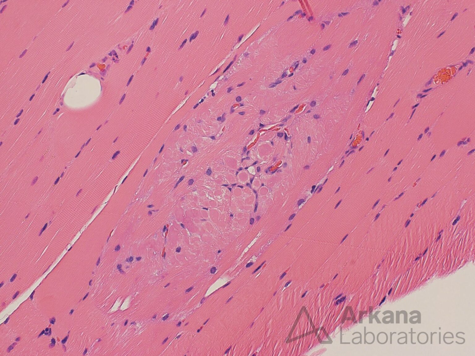 Split muscle fiber | Neuro Notes | Arkana Laboratories