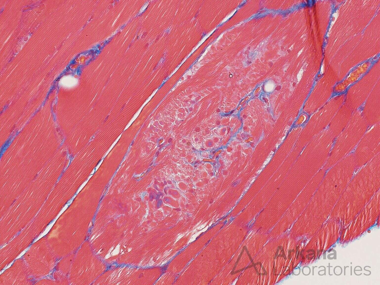 Split muscle fiber | Neuro Notes | Arkana Laboratories