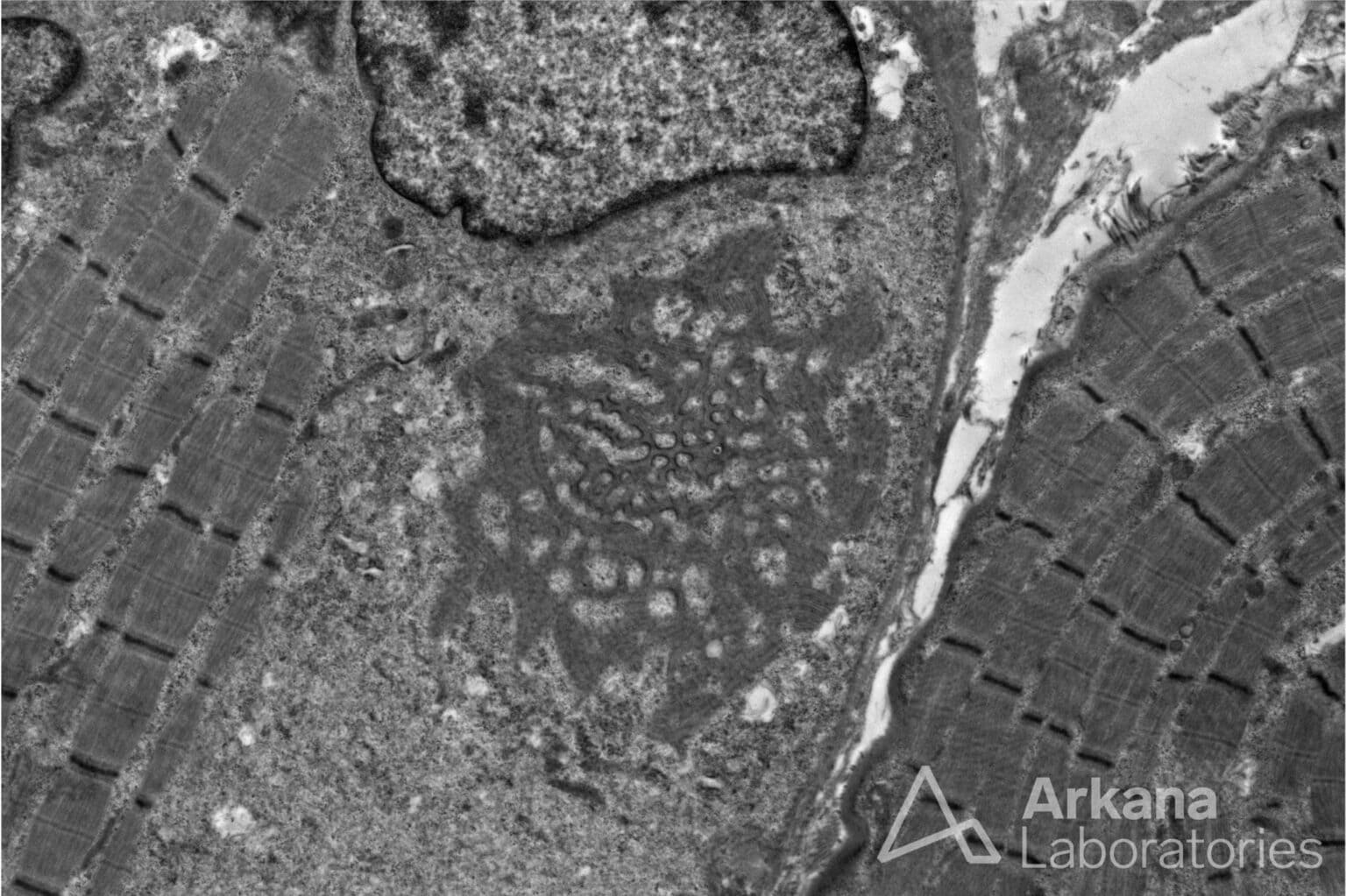 Neuromuscular junction in 60-year-old patient | Neuro Notes | Arkana ...
