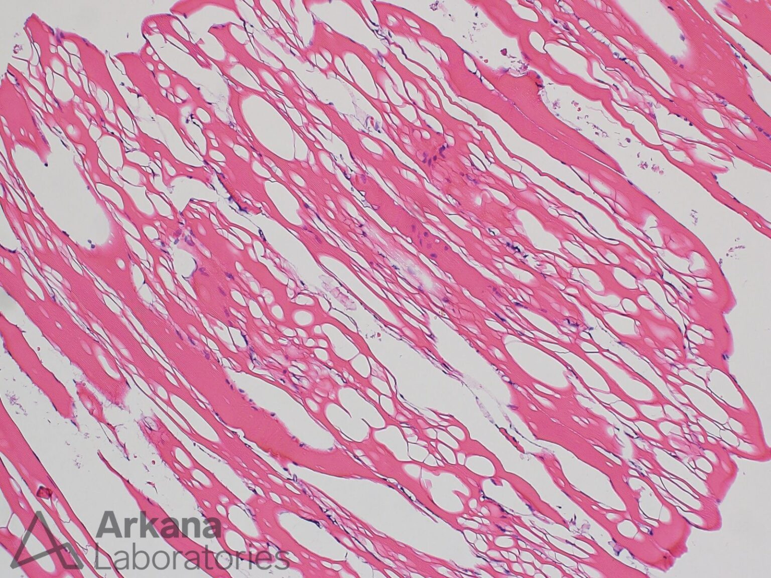 Freezing artifact formalin-fixed tissue - Arkana Laboratories