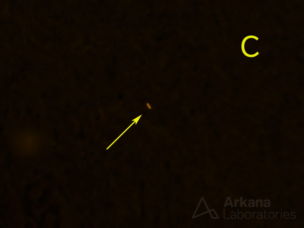 Tuberculosis | Teaching Points | Arkana Laboratories