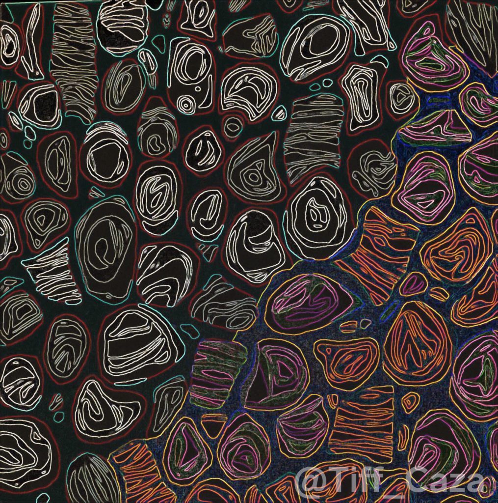 Fabry Disease in Female Carriers - Arkana Laboratories