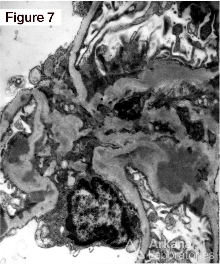 HIVICK & HIV | Teaching Point | Arkana Laboratories