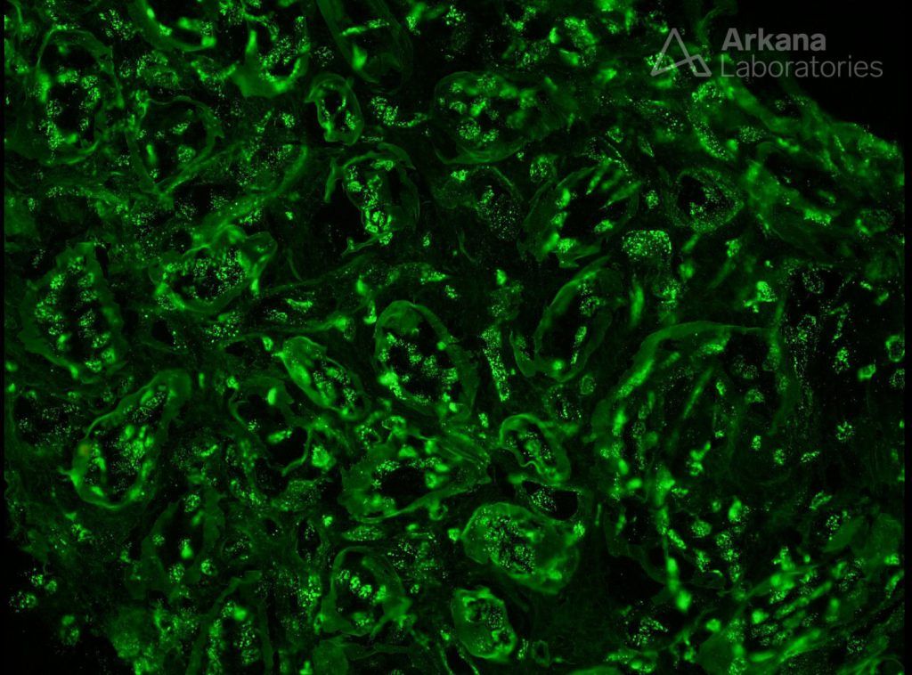 Tissue Antinuclear Antibodies | Teaching Points | Arkana Laboratories