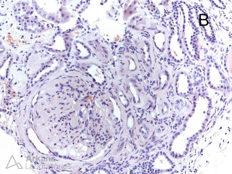 Congo Red Stain Tutorial | Teaching Points | Arkana Laboratories